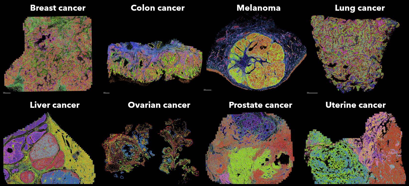 MERSCOPE Immuno-Oncology Panel