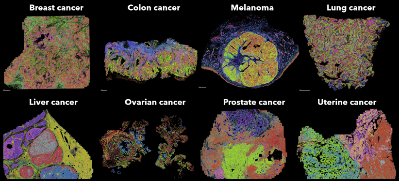MERSCOPE Immuno-Oncology Panel