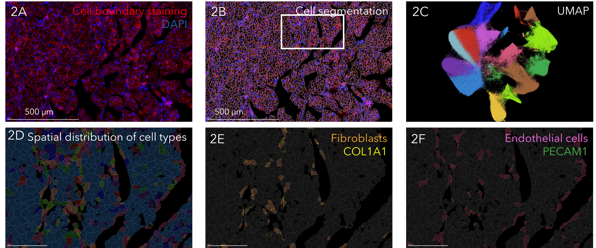 MERSCOPE FFPE Solution Showcase