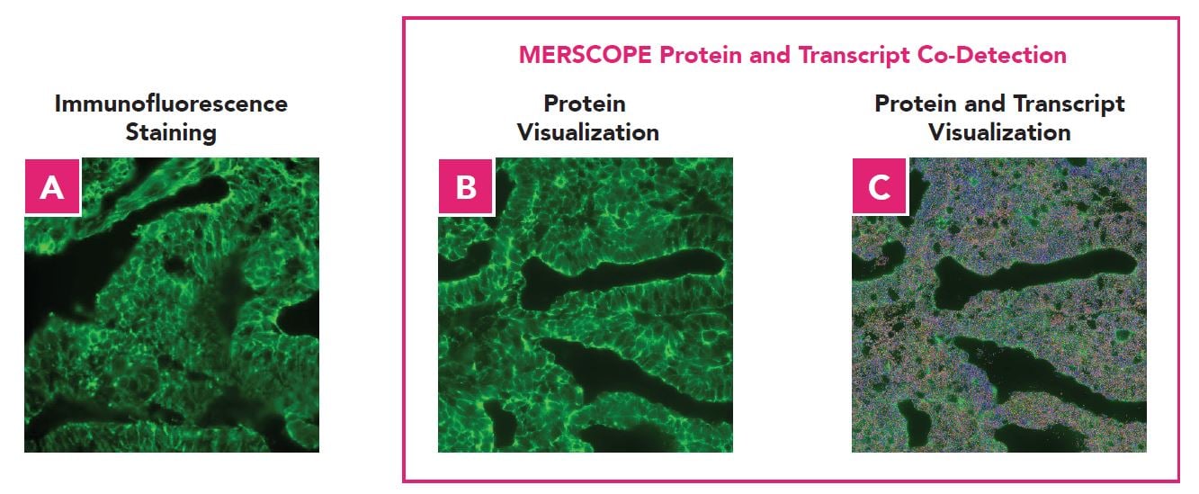 Vizgen MERSCOPE Protein Co-Detection