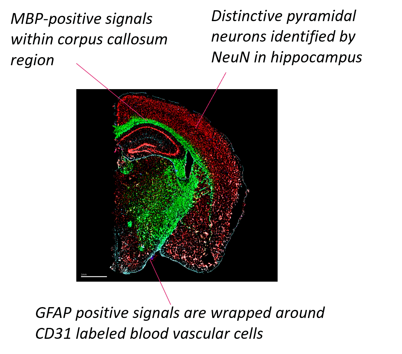 Vizgen MERSCOPE Protein Co-Detection
