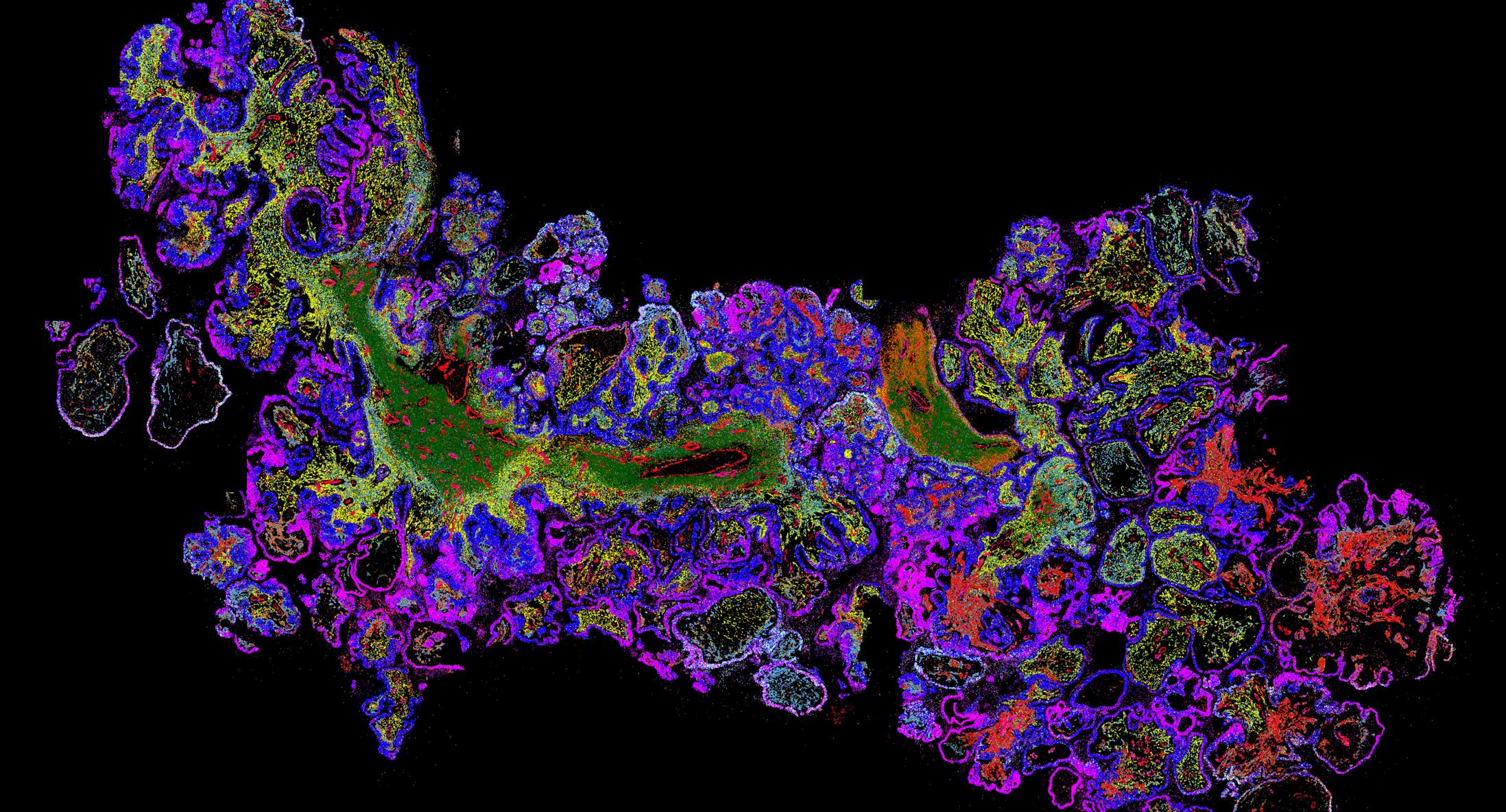 MERSCOPE FFPE Solution Showcase